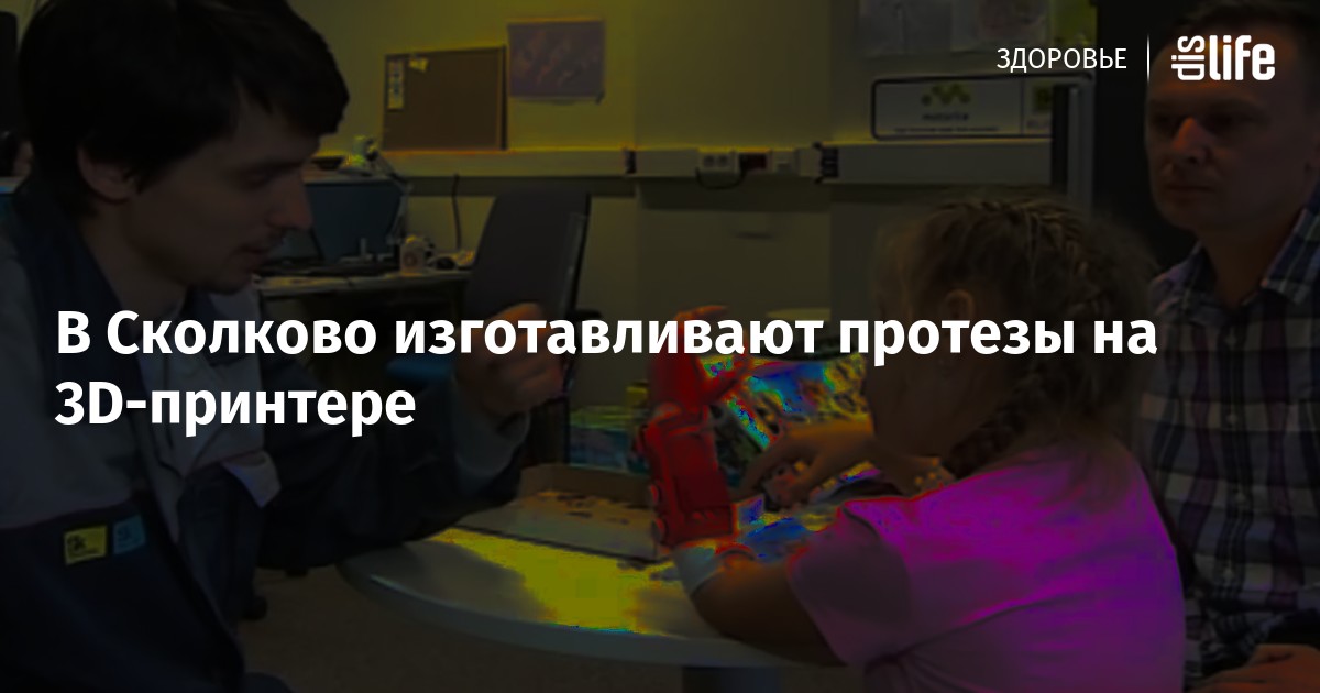В Сколково изготавливают протезы на 3d принтере — категория Здоровье